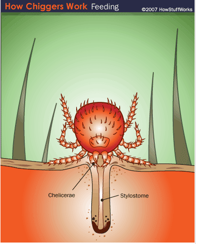 Chiggers Attack! – Peru, IN – Lowes Travels